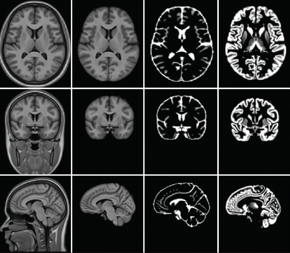 Medical Image Processing @ CVIT, IIIT Hyderabad